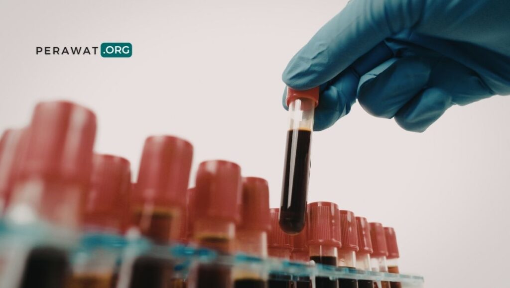 Nilai Normal Indeks Eritrosit: MCV, MCH, dan MCHC - Perawat.org
