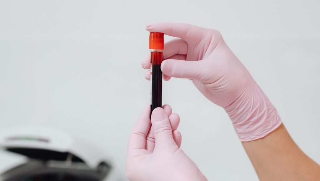 Interpretasi Nilai Normal Hemoglobin (Hb) - Perawat.org